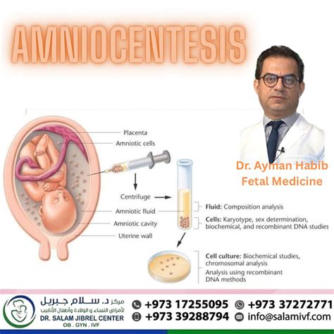 Amniocentesis Is A Medical مركز الدكتور سلام جبريل الطبي Facebook