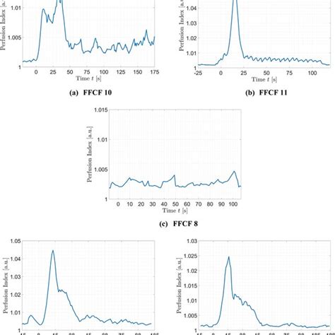 perfusion index pi the blue curve represents the average of all