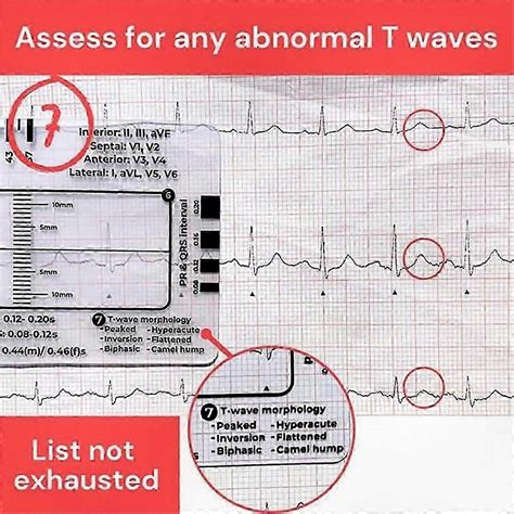 2pcs Ecg 7 Step Measuring Guide Ecg Interpretation Tool For Medical