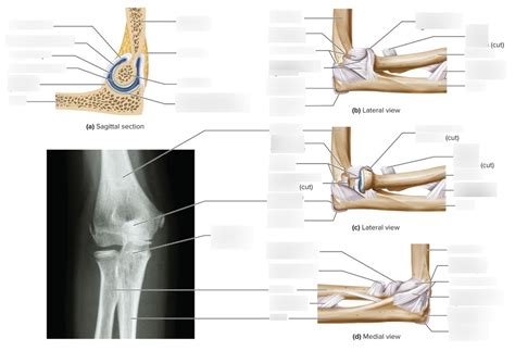 Right Elbow Joint Diagram Quizlet