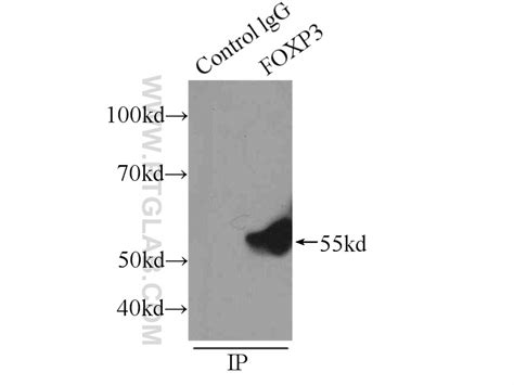 Foxp3 Antibody 22228 1 Ap Proteintech 武汉三鹰生物技术有限公司