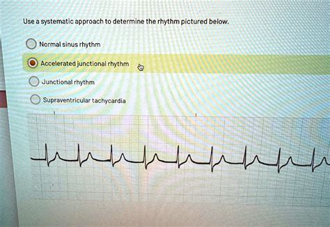 Use A Systematic Approach To Determine The Rhythm Pictured Below Normal