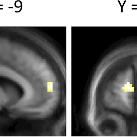 Psychophysiological Interactions Spm Showing Difference In Functional