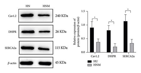 Nrf2 Inhibitor Blocks The Activation Of Ca²⁺ Serca2a Under Nbp