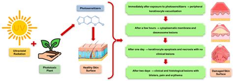 New Insights Concerning Phytophotodermatitis Induced By Phototoxic Plants Pmc
