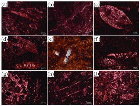 Photomicrographs Showing A Coralline Algae And Idalina Grelaudae Download Scientific Diagram