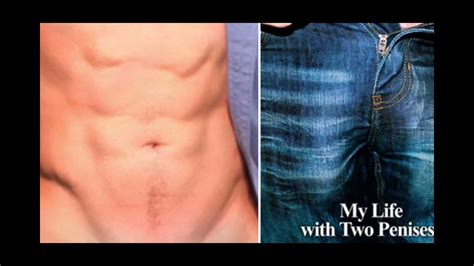 Man With 2 Penises Youtube