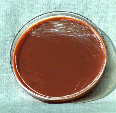 Free Picture Brucella Bacteria