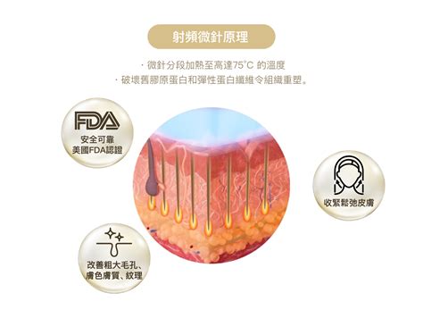 Exion™ Ai智能微針 Skin And Co