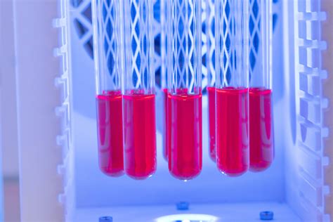 Weg Zur Dezentralen Erzeugung Von Grünem Wasserstoff Dielindeonline