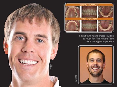 Vto Patient Orthodontics Before And After Pictures Damon Braces