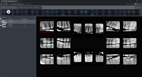 Leadtools Medical Suite Sdk