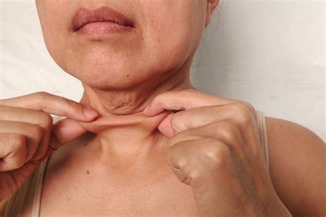 Sagging Neck Skin After Weight Loss Irvine Neck Treatments