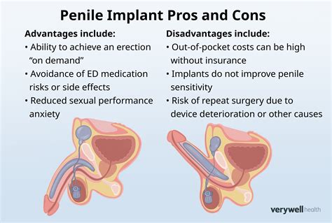 Penile Fracture Treatment Without Surgery