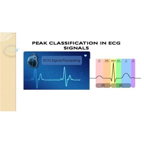Detecting Diseases Using Ecg Peak Classification Approach Techpacs Canada Limited