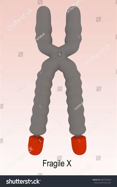 3d Illustration Chromosome Fragile X Script Stock Illustration