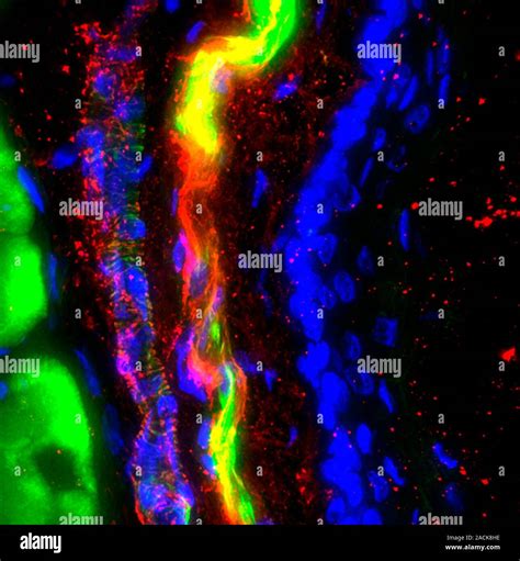 Throat Tissue Fluorescence Deconvolution Micrograph Of A Section