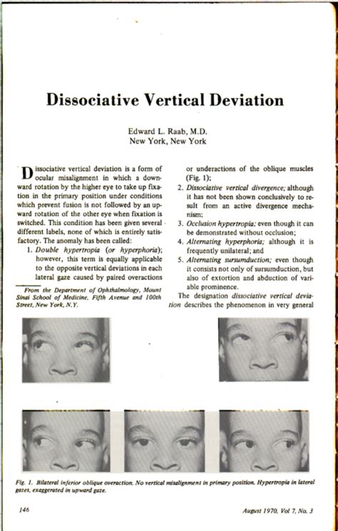 Dissociative Vertical Deviation Journal Of Pediatric Ophthalmology