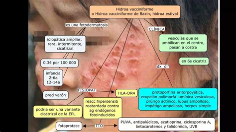 Fotodermatosis Pptx