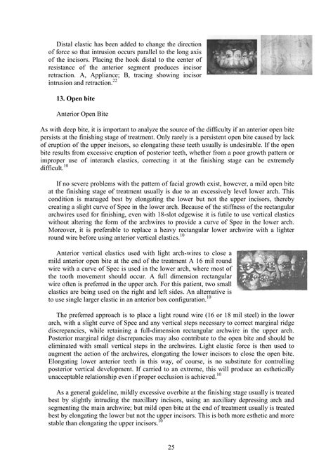 Elastics In Orthodontics Pdf