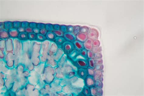 Conifer Needle With Environmental Damages Under A Microscope Stock