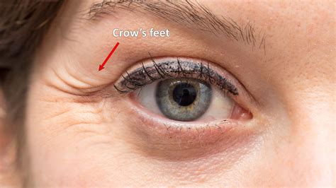Crows Feet Eyes Nutt So Ruff