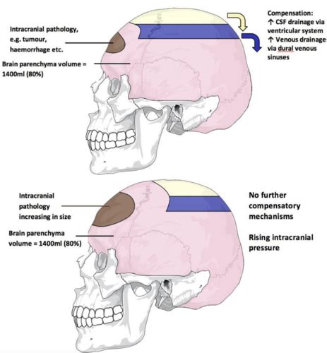 Anatomy Icp And Herniation Flashcards Quizlet