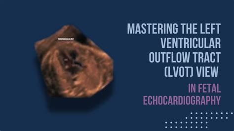 Mastering The Left Ventricular Outflow Tract Lvot View In Fetal Echocardiography