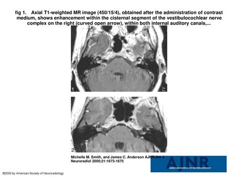 Fig 1 Axial T1 Weighted Mr Image 450 15 4 Obtained After The