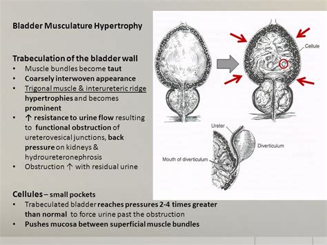 Urinary Obstruction And Stasis Group 1 3 C Navarro Nuevo Ppt Download