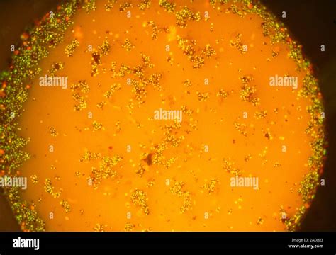 HIV Blood Test By HLA Typing Fluorescent Light Micrograph View Of Human White Blood Cells