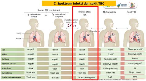 Diagnosis TBC Pada Dewasa OK Pptx