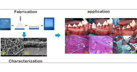 Bilayered Plgawool Keratin Composite Membranes Support Periodontal