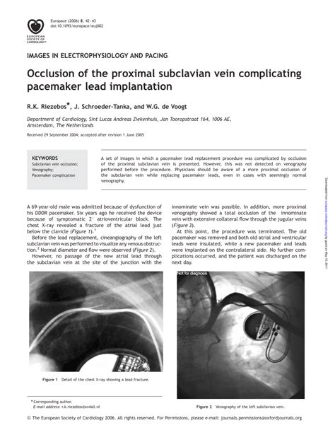 Pdf Occlusion Of The Proximal Subclavian Vein Complicating Pacemaker Lead Implantation