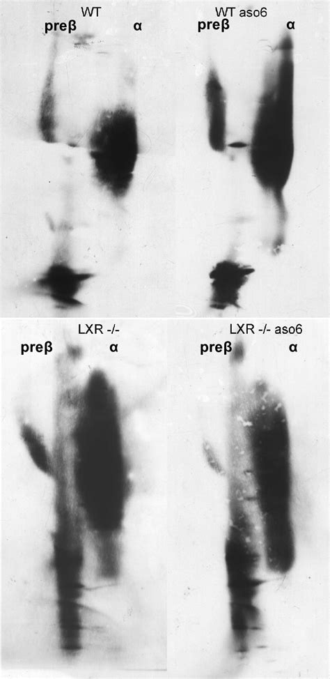 hdl subclasses hdl subclasses were separated by 2d electrophoresis and