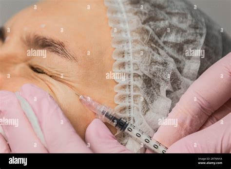 Contour Plastic A Cosmetologist Injects A Botulinum Toxin To Tighten And Smooth Out Wrinkles On
