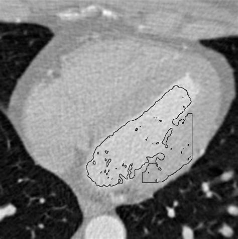segmentation results by using the first image of figure 1with the