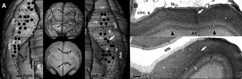 Primary Generators Of Visually Evoked Field Potentials Recorded In The Macaque Auditory Cortex