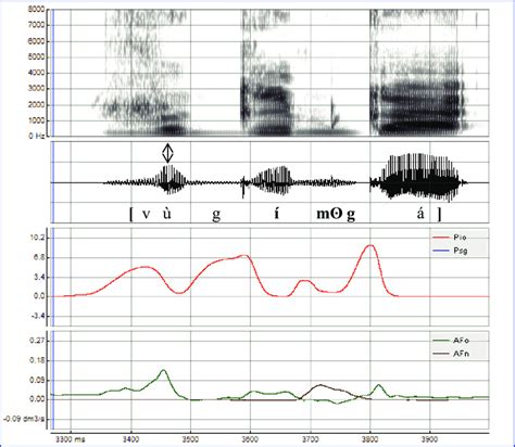 Spectrogram Audio Waveform Intraoral Pressure Po Oral Airflow