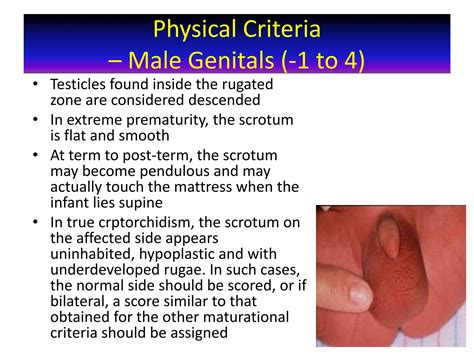 Assessment Of Gestational Age Pptx