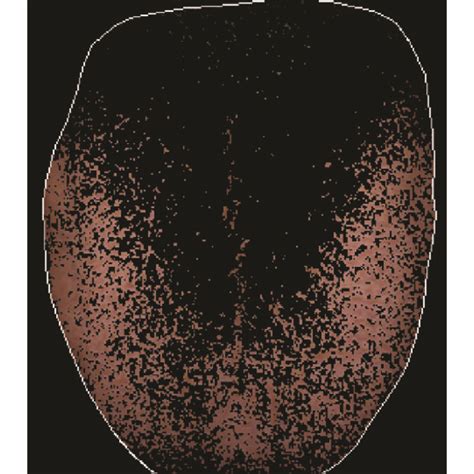 Illustrations Show A An Original Tongue Image B Segmented Tongue Download Scientific Illustrations Show A An Original Tongue Image B Segmented Tongue Download Scientific