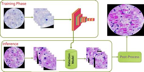 Kinde Anlay Fante On Linkedin Tile Based Microscopic Image Processing For Malaria Screening