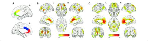 Functional Connectivity Of Anterior Cingulate Cortex Acc