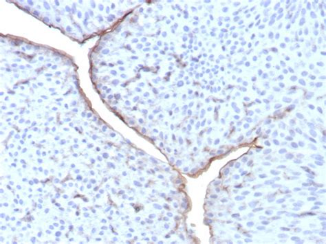 Uroplakin 3b Upk3b Marker Of Mesothelial And Umbrella Cells Recombinant Monoclonal Antibody