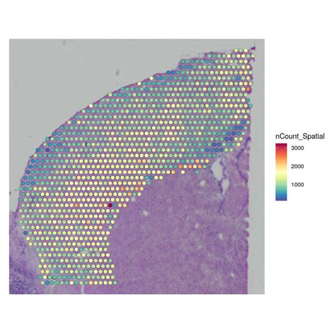 Multi Resolution Deconvolution Of Spatial Transcriptomics In R Scvi Tools