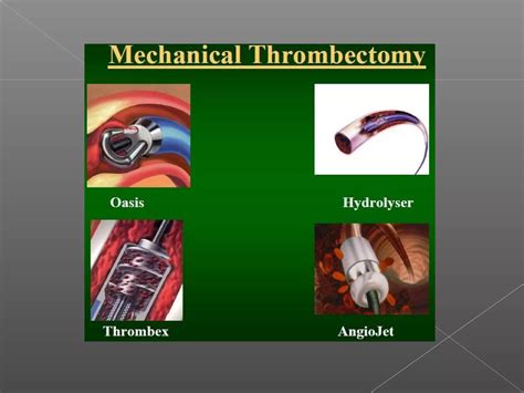 Acute Limb Ischemia Pptx