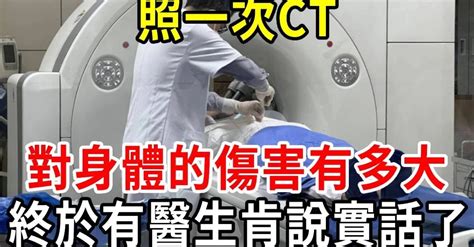 照一次ct，對身體的傷害有多大？終於有醫生站出來說實話了，看完真的嚇了一跳！