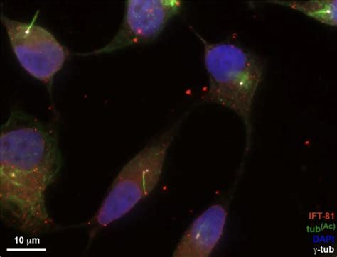 使用免疫荧光染色和matlab分析定量测定初级纤毛蛋白分布 知乎