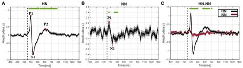 Anterior Cingulate Cortex