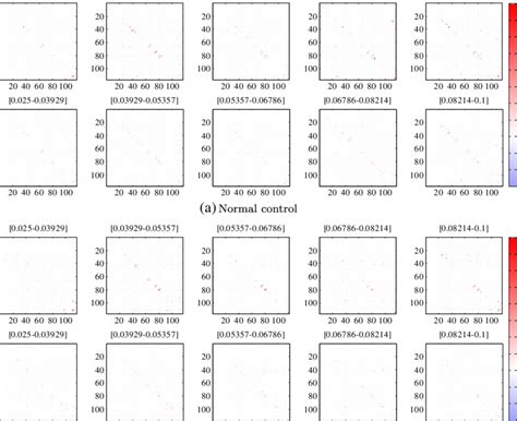 Comparison Of The Functional Connectivities Of A Normal Control Subject